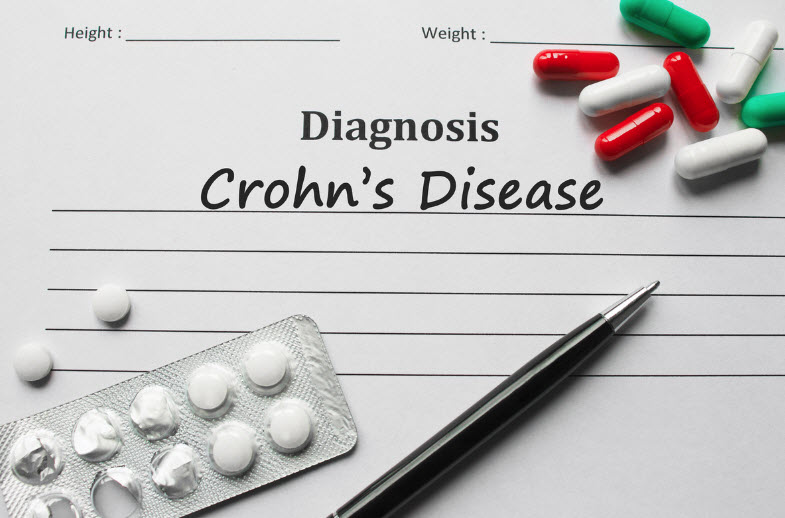 Finding relief from Crohn’s disease with Entocort® EC | Healthy Living ...