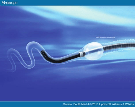 Balloon Endoscopy Procedure