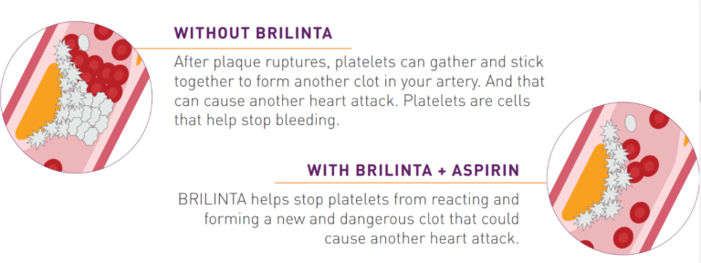 Generic Brilinta For Post-Acute Coronary Syndrome Management Is ...